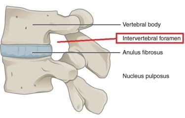 Lumbal skiveprolaps – Del 1: Hva er prolaps? – Manuellterapeuten